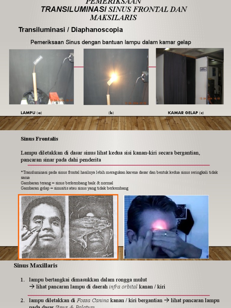 Pemeriksaan Sinus | PDF
