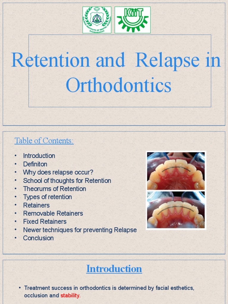 Retention and Relapse in Orthodontics | PDF | Orthodontics | Tooth