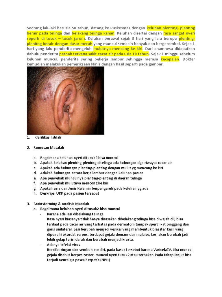Plenting Telinga Akibat Herpes Zoster | PDF