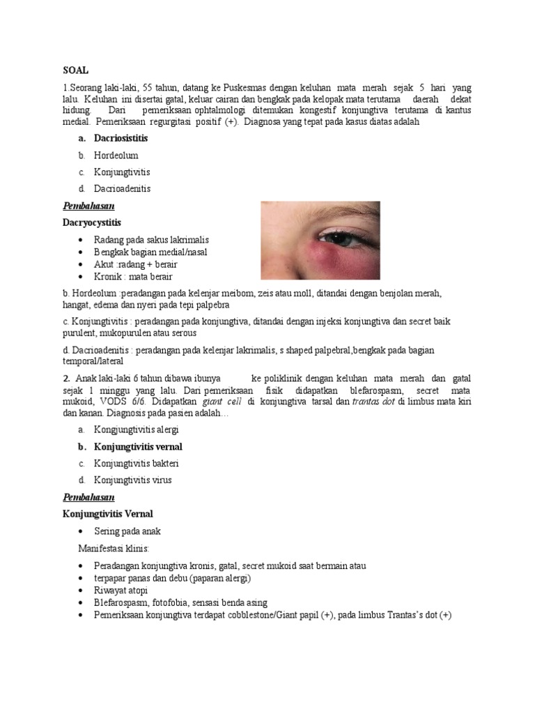 Quiz Mata | PDF
