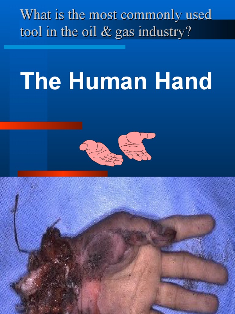 Fingers Don't Grow Back | PDF | Personal Protective Equipment | Hand