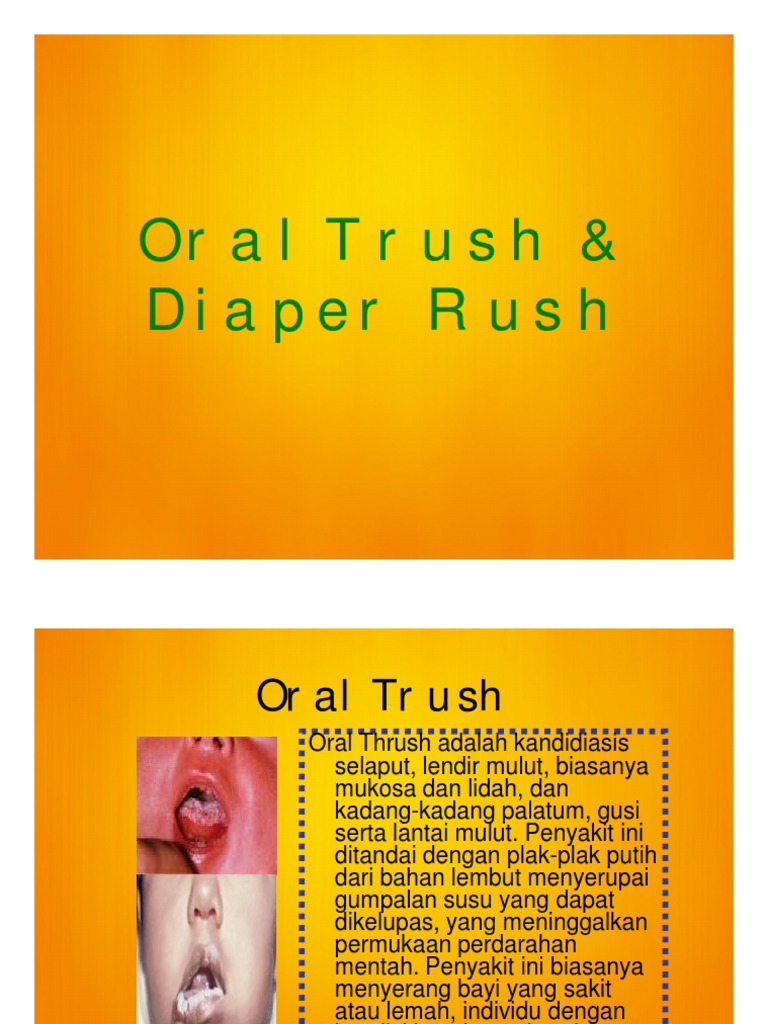 Oral Trush & Diaper Rush (Compatibility Mode) | PDF