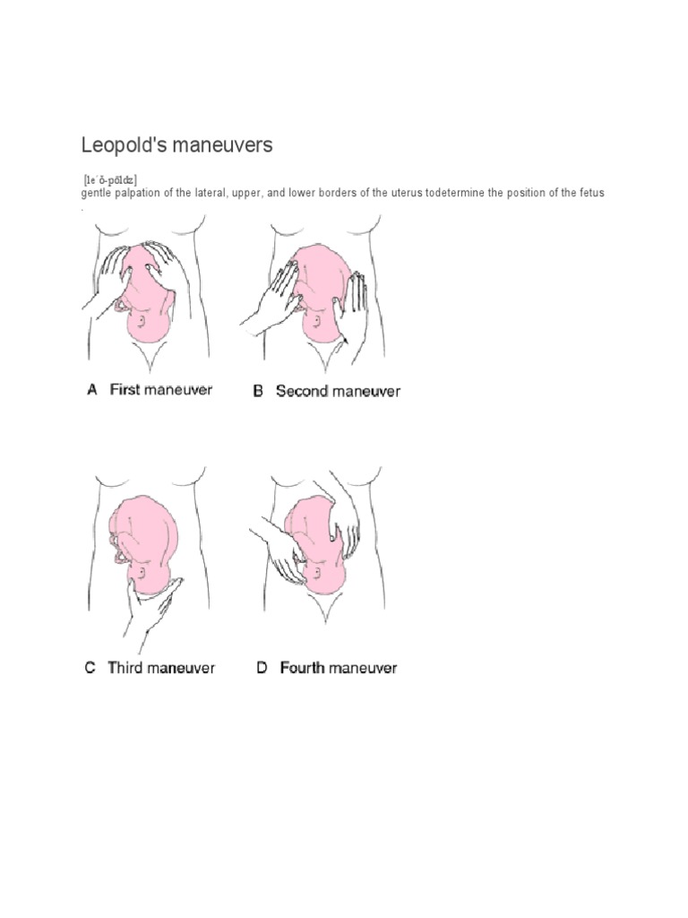 Leopold's Maneuver | PDF | Obstetrics | Motherhood