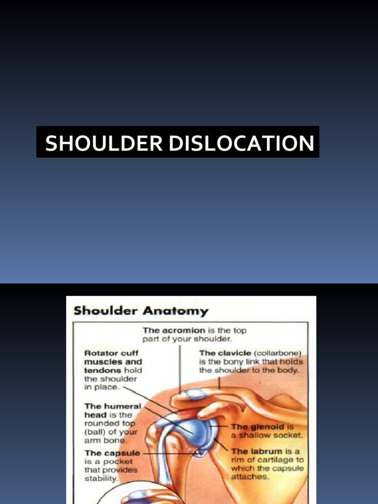 Shoulder Dislocation | PDF | Shoulder | Musculoskeletal System