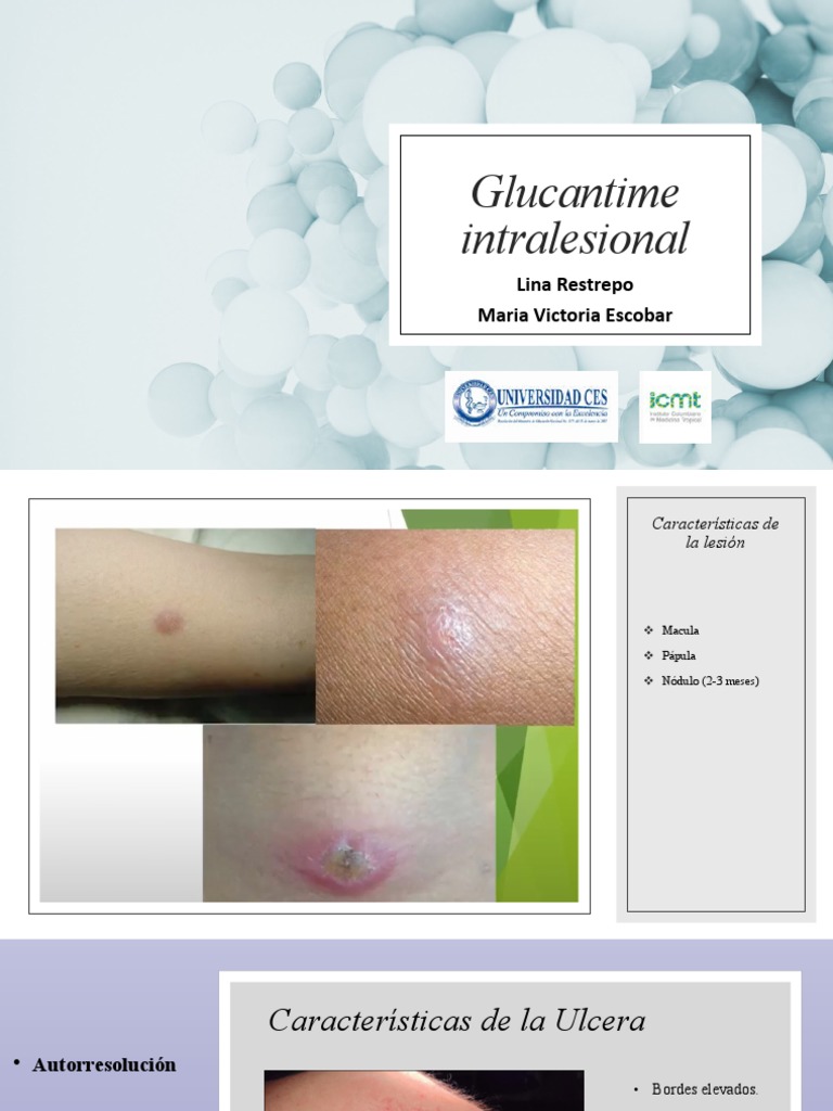 Glucantime Intralesional (3935) | PDF | Especialidades Medicas ...