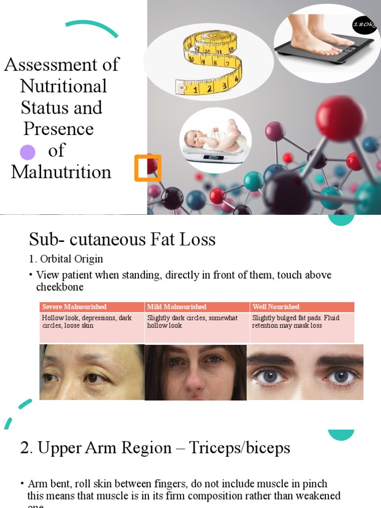 Assessment of Nutritional Status and Presence of Malnutrition | PDF ...