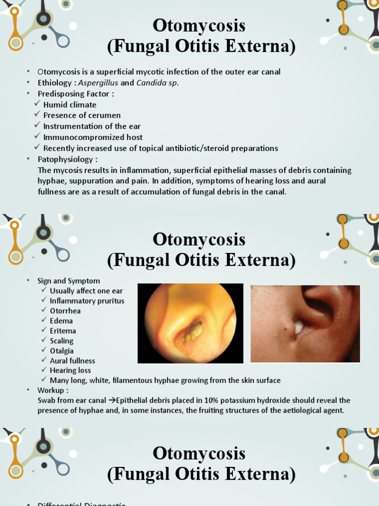 Otomycosis, Tinea Capitis | PDF | Dermatology | Epidemiology