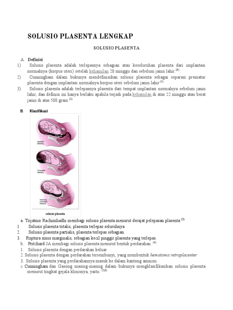 Solusio Plasenta Lengkap | PDF