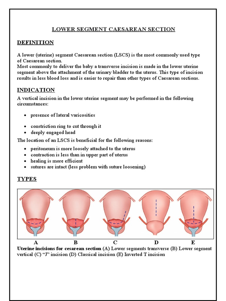 Lower Segment Caesarean Section Guide | PDF | Caesarean Section | Uterus