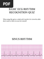 ECG - EKG Practice Quiz (Identify Rhythms) | PDF | Electrocardiography | Internal Medicine