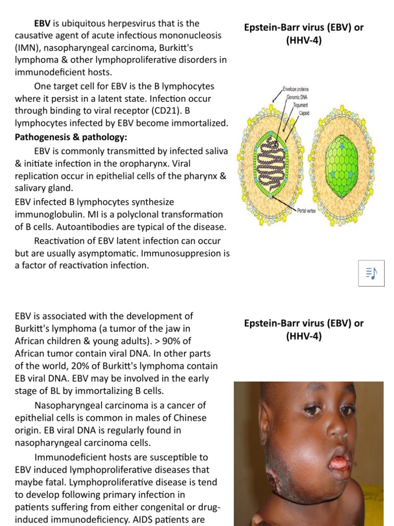 Epstein-Barr Virus (EBV) or (HHV-4) : EBV Is Ubiquitous Herpesvirus ...