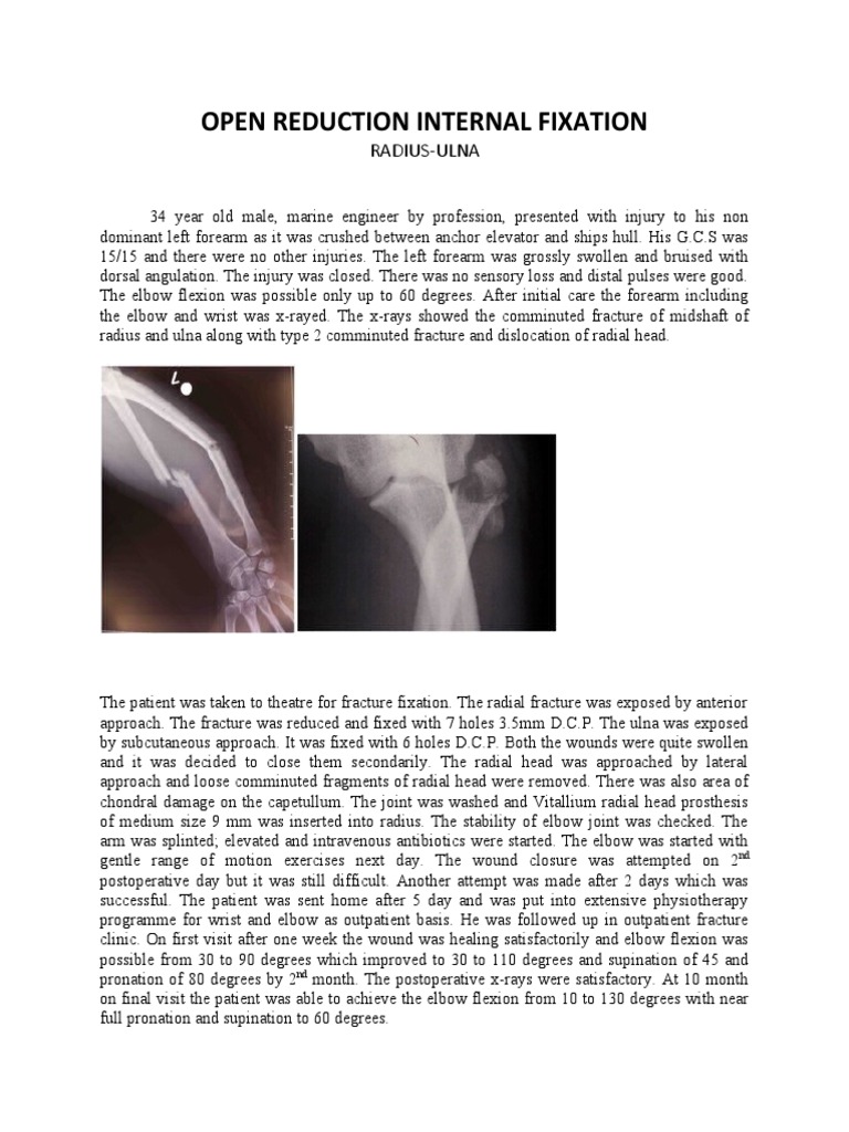 Open Reduction Internal Fixation | PDF | Elbow | Anatomical Terms Of Motion