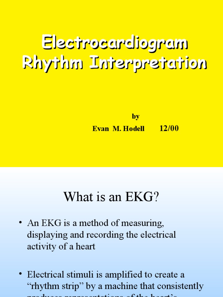 Interpreting Heart Rhythms: A Guide to EKG Rhythm Analysis in Humans ...