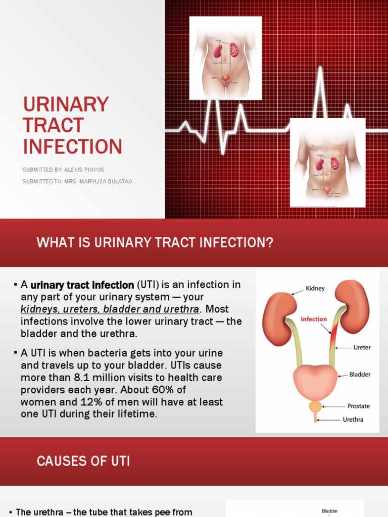 Urinary Tract Infection | PDF | Urinary Tract Infection | Urinary System