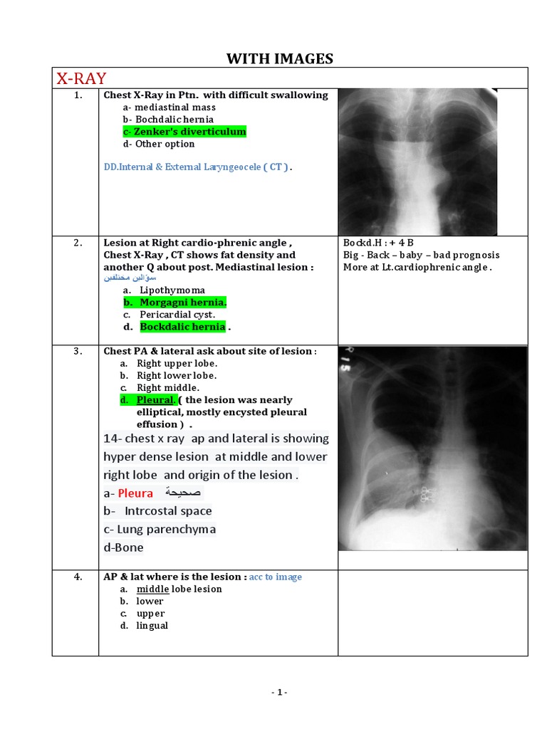 Chest PDF | Download Free PDF | Lung | Pneumonia