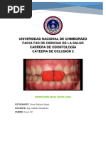 Jig de Lucía: Técnica y Aplicaciones | PDF | Naturaleza
