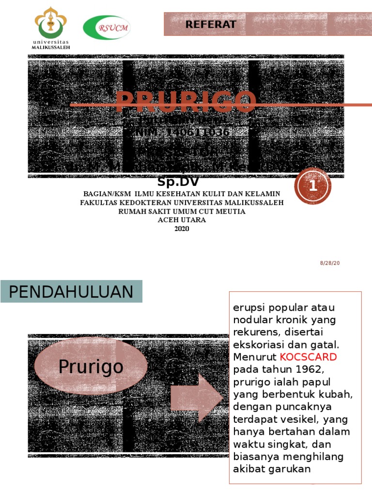 Referat PPT Prurigo | PDF