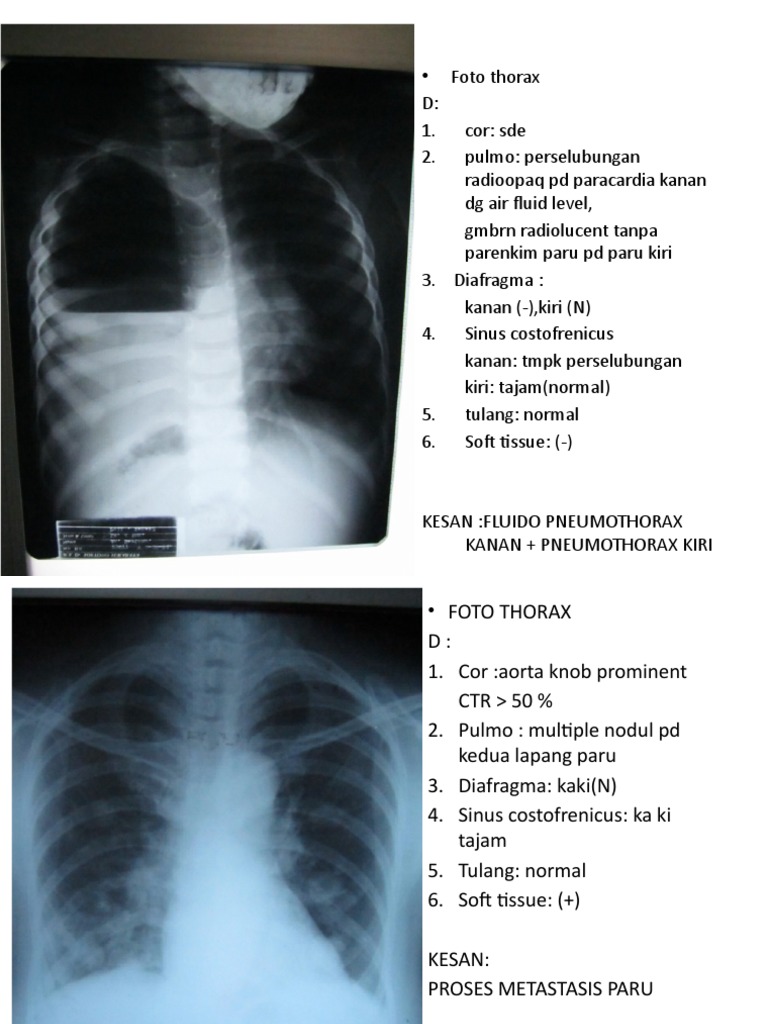 Foto Thorax | PDF