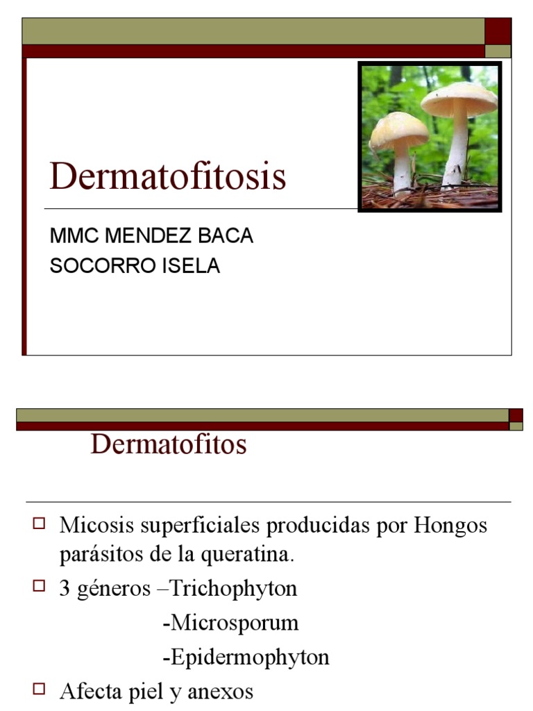 Dermatofitosis: una guía completa sobre su etiología, manifestaciones ...
