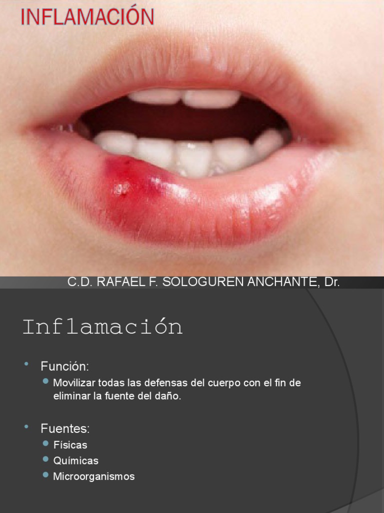 Procesos inflamatorios y reparativos en la cavidad bucal | PDF ...