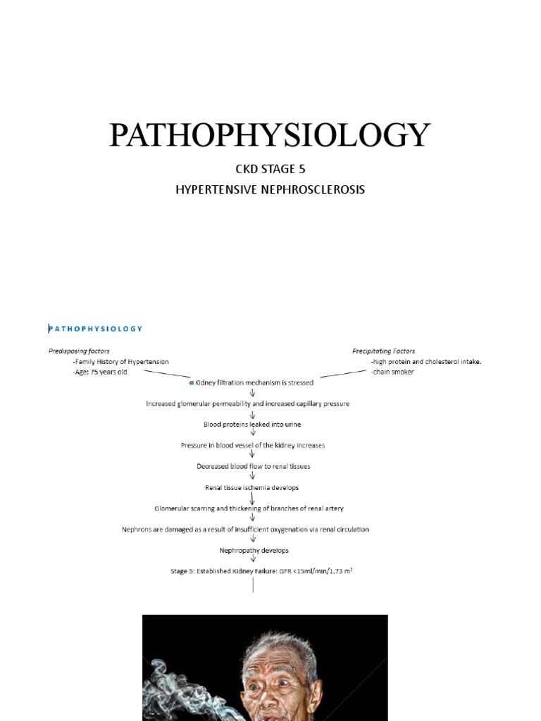 CKD Stage 5: Hypertensive Nephrosclerosis | PDF