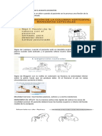Signo de Hoffman y su significado clínico | PDF | Síndrome del túnel ...