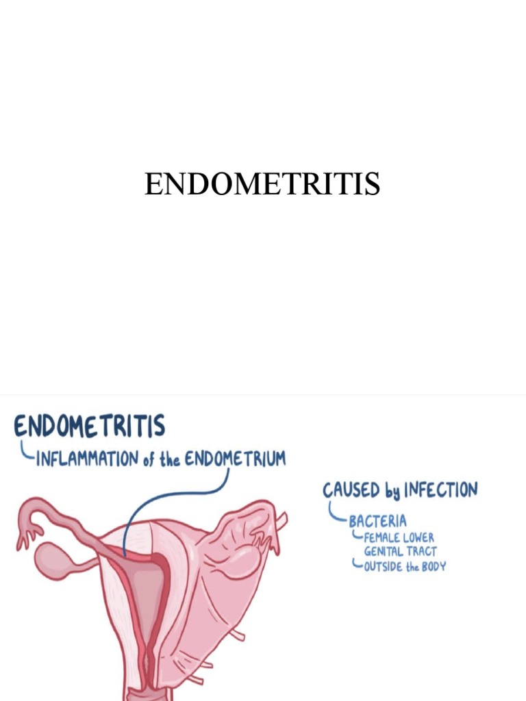 Gejala dan Terapi Endometritis | PDF