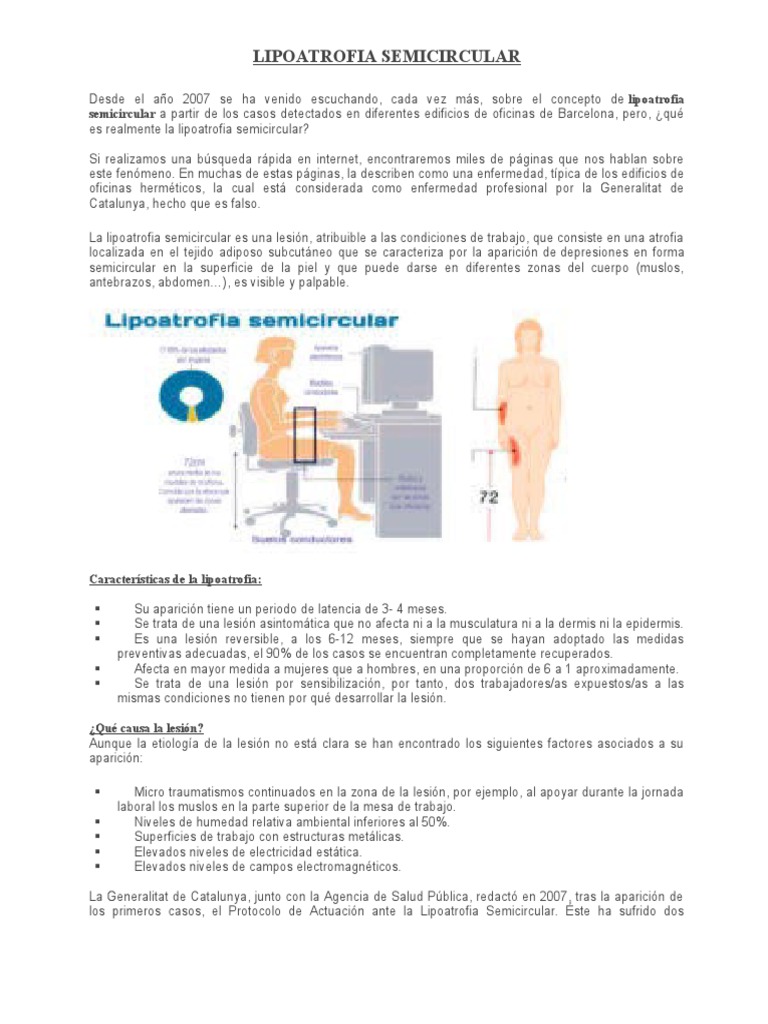 Lipoatrofia Semicircular | PDF | Electrostática | Descarga electrostática