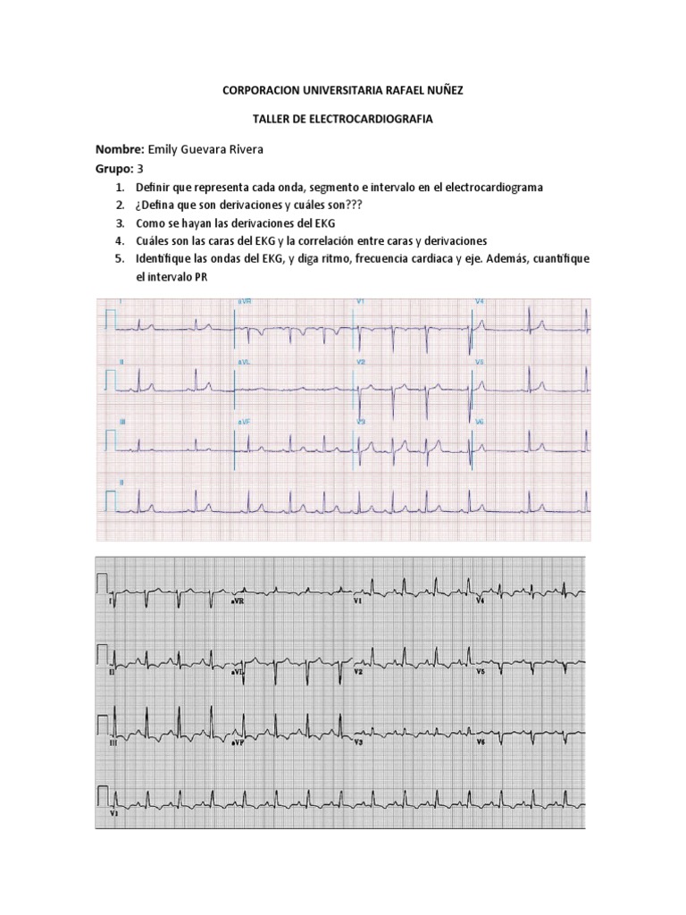 Taller Ekg - Emily Guevara | PDF | Electrocardiografia | Electrofisiología cardíaca