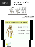Técnica Quirúrgica Placa Philos: Conceptos | PDF | Tornillo | Metalurgia