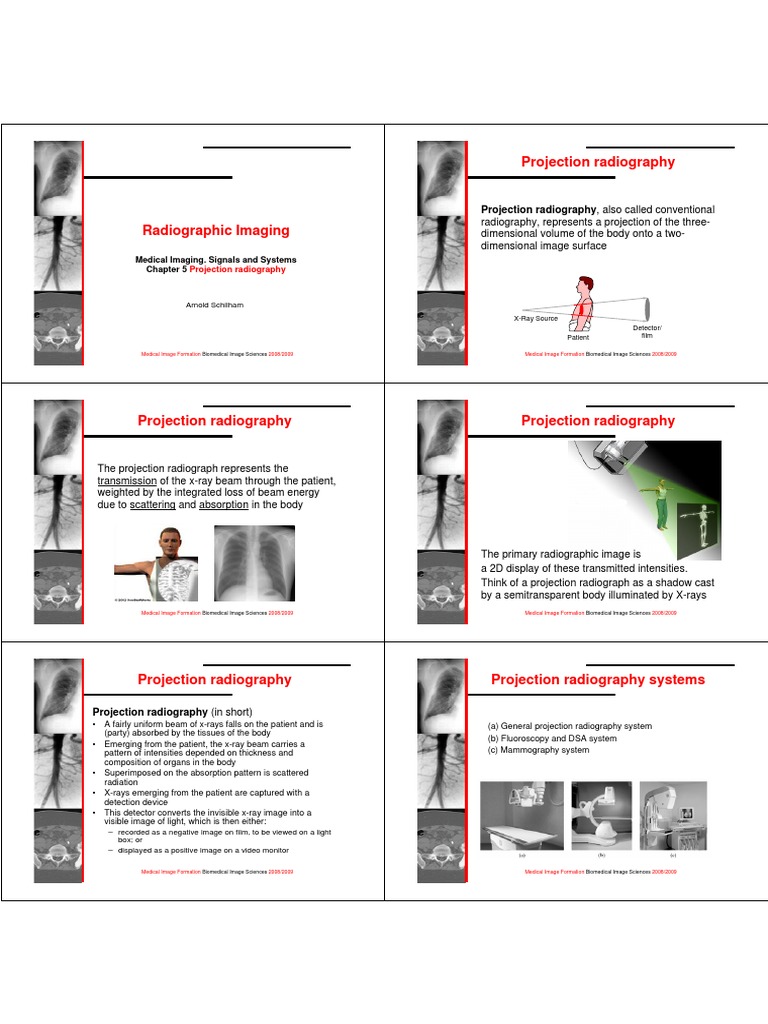 Projection Radiography Overview | PDF | Radiography | X Ray