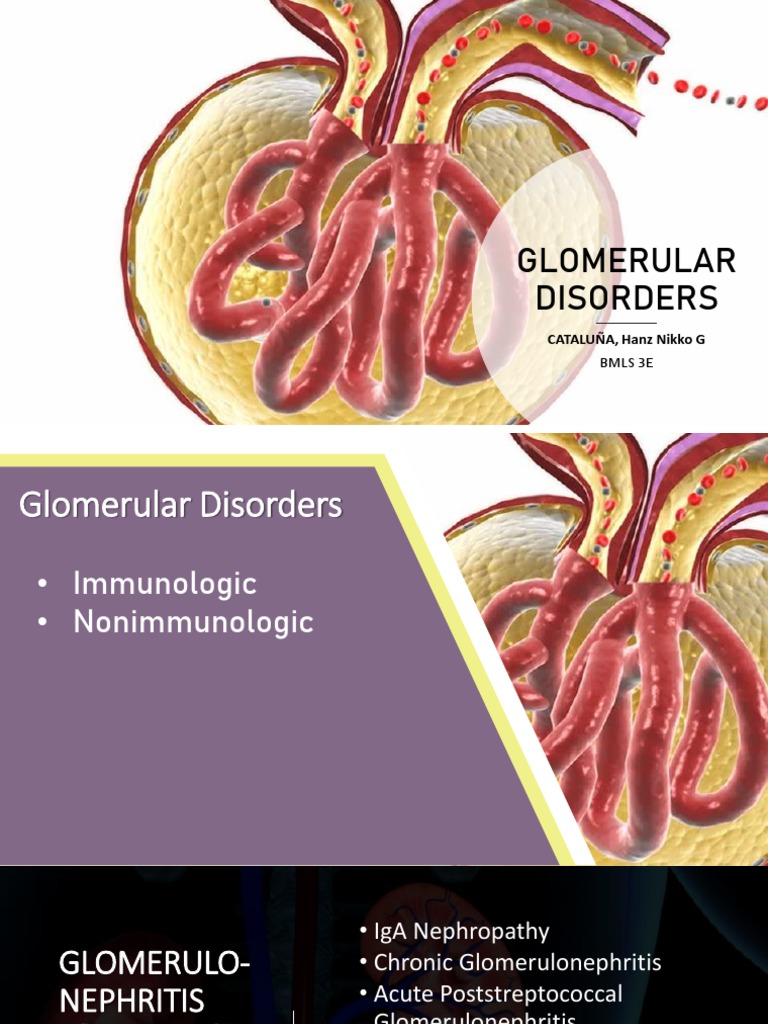 Glomerular Disorders: CATALUÑA, Hanz Nikko G | PDF | Anatomy | Nephrology