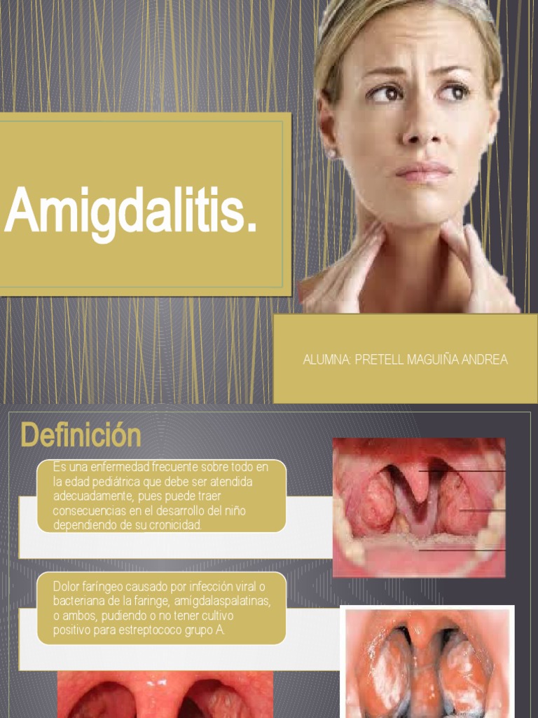 Amigdalitis | PDF | Virus | Rtt