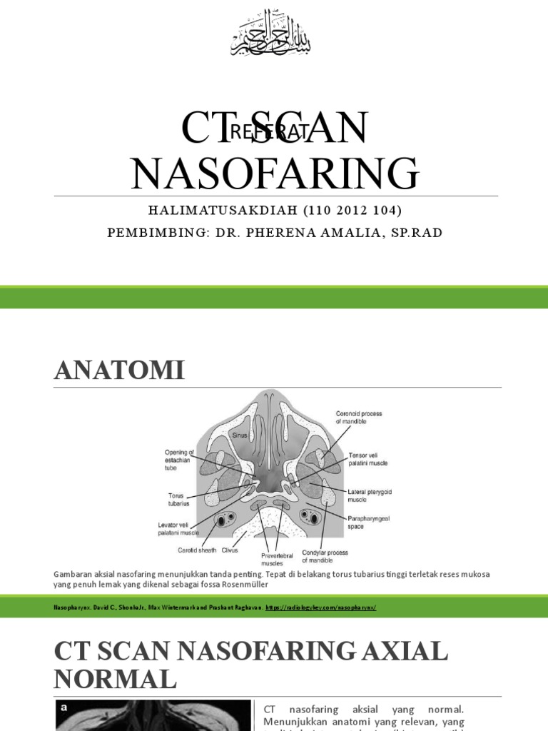 CT Scan Nasofaring | PDF