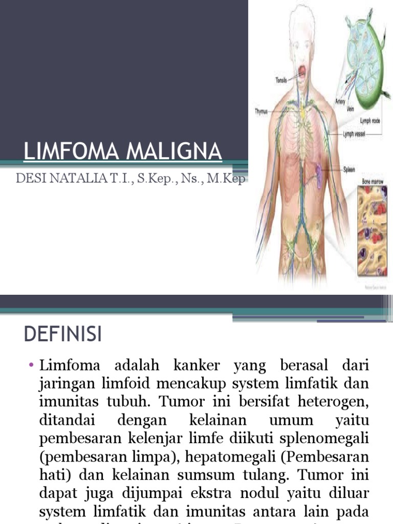 KLASIFIKASI DAN GEJALA LIMFOMA MALIGNA | PDF