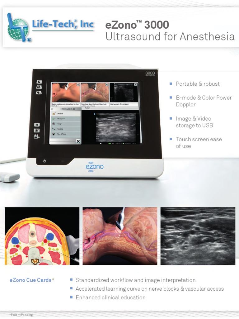 Ultrasound For Anesthesia: Ezono 3000 | PDF | Usb | Medical Ultrasound