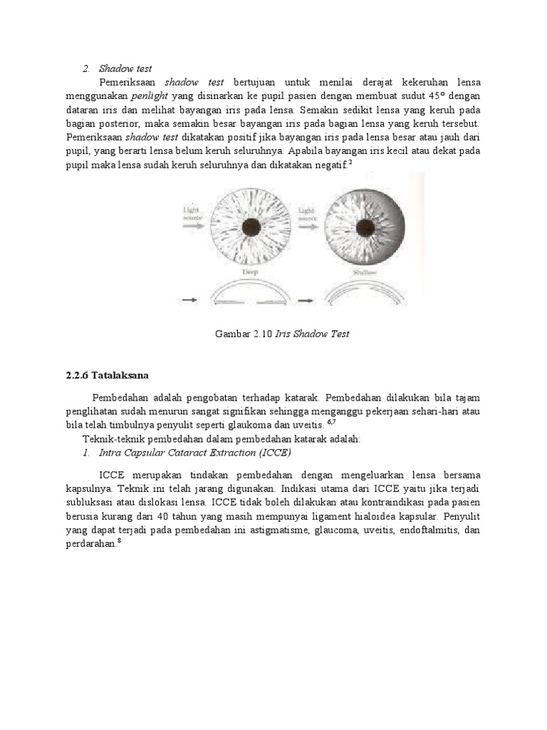 Pemeriksaan Shadow Test Katarak | PDF