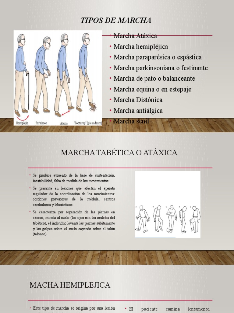 Tipos de Marcha Patológica | PDF | Pie | Distonia