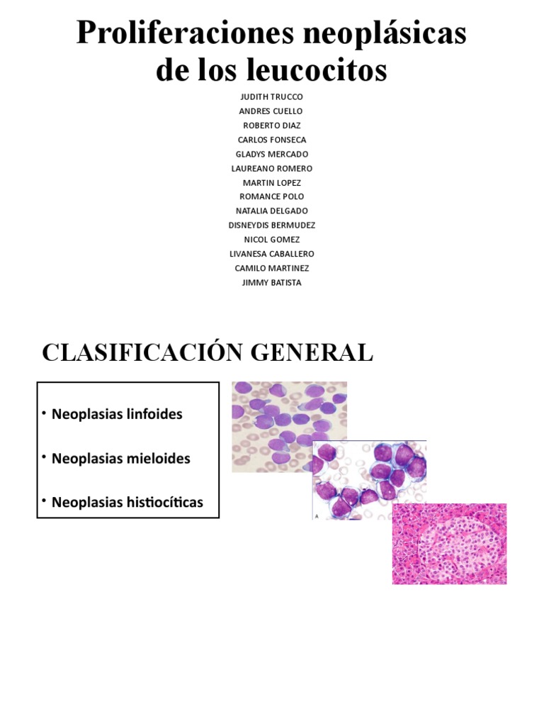 Proliferaciones Neoplásicas de Los Leucocitos Diapos | PDF | Linfoma ...