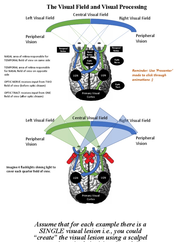 Visual Deficits Animation | PDF | Visual System | Retina