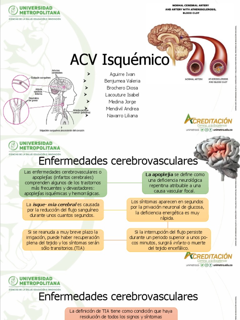 Acv Isquemico | PDF | Carrera | Isquemia