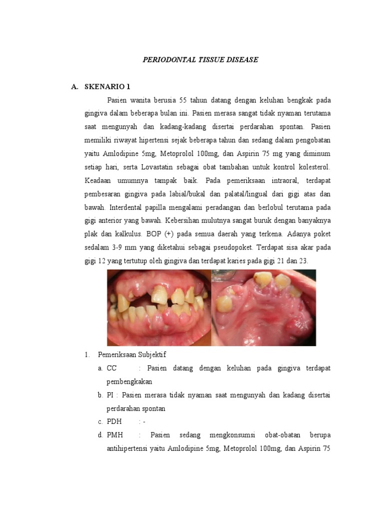 Penyakit Jaringan Periodontal: Diagnosis dan Perawatan | PDF