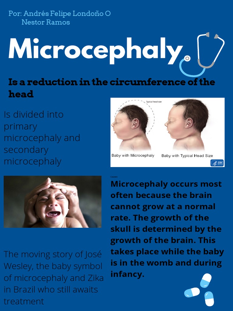 Microcephaly: Is A Reduction in The Circumference of The Head | PDF