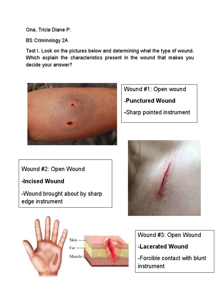 CDI Wounds | PDF