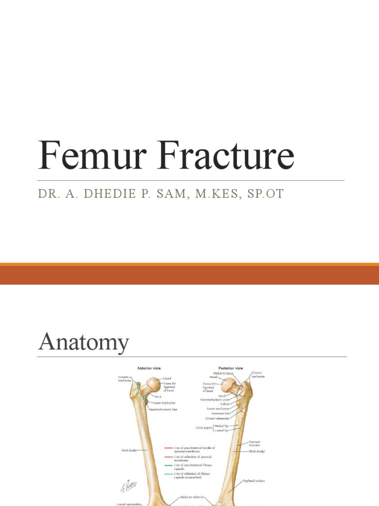 Types and Mechanisms of Femur Fractures | PDF | Hip | Knee
