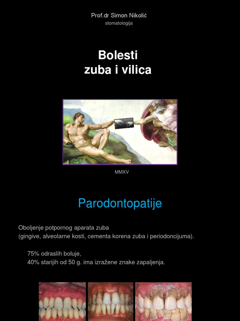 Bolesti Zuba PDF | PDF