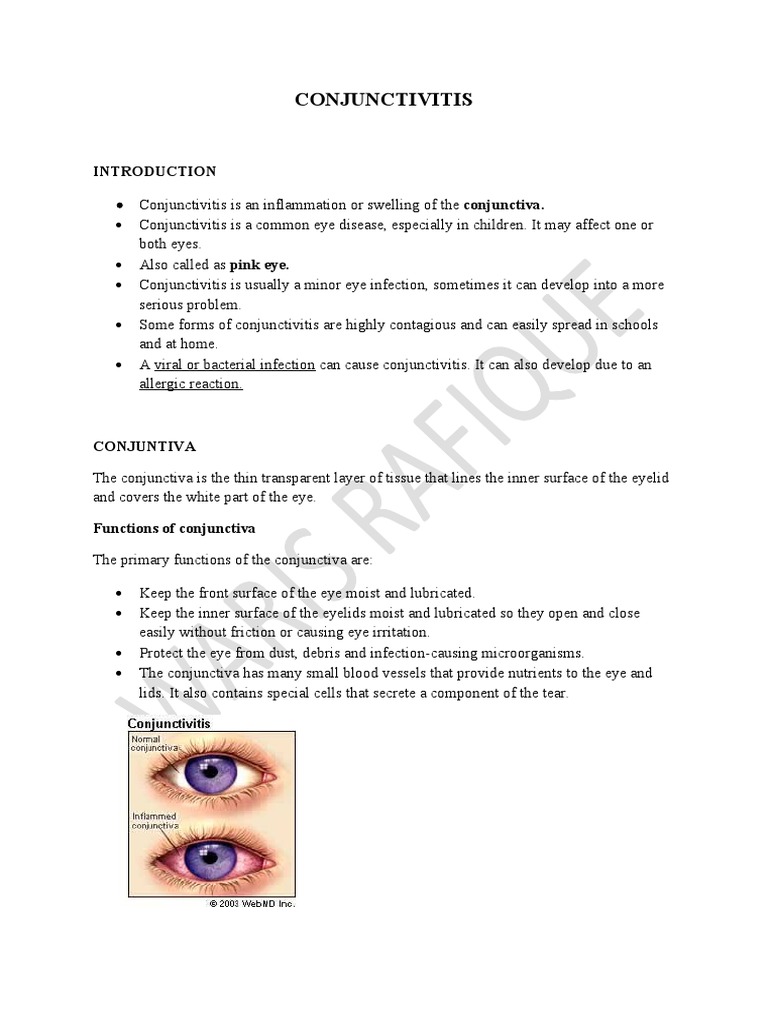 CONJUNCTIVITIS | PDF | Allergy | Epidemiology