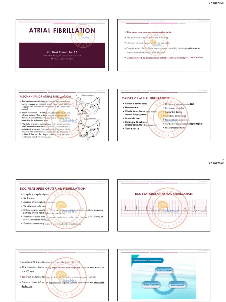 Dopamed - Id Atrialfibrillation Handout PDF | PDF | Cardiac Arrhythmia ...