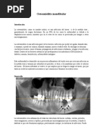 Curva de Spee y Wilson | PDF | Ortodoncia | Odontología