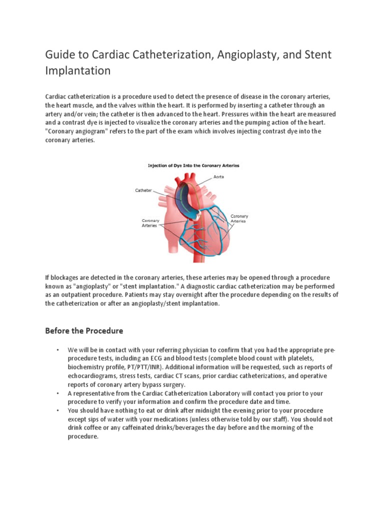 Guide To Cardiac Catheterization, Angioplasty, and Stent Implantation ...